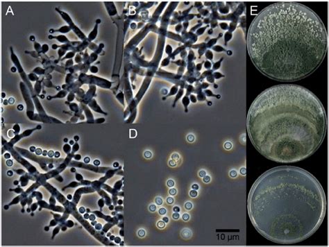 Trichoderma Atrobruneum Kuc21223 A C Conidiophore D Conidia