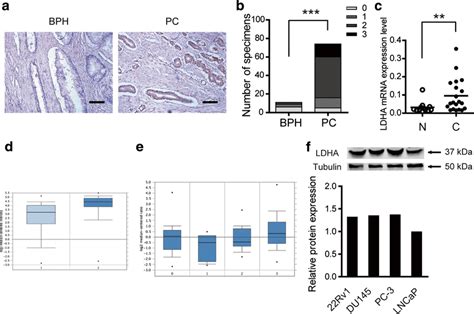 Altered Expression Of LDHA Was Observed In PC A Representative Images Download Scientific