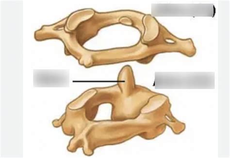 C1 And C2 Cervical Vertebrae Labelling Diagram Quizlet