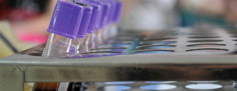 Factor Ii Prothrombin Assay