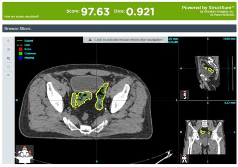 Sigmoid Proknow Tyler Calhoun Bs Rtrt
