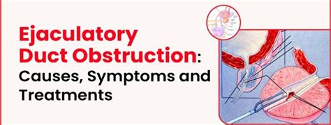 Ejaculatory Duct Obstruction Causes Symptoms And Treatment