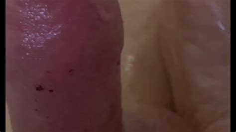 Diagnosis Medical Fetish Call The Doctor Free Sex Video Redtube