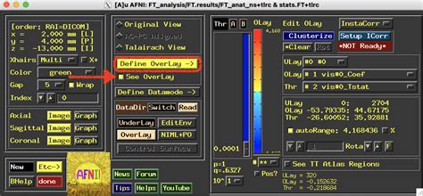 5 1 5 Afni Gui Overlay Panel — Afni Suma And Fatcat V25 2 10