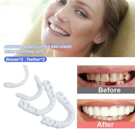 Smile Teeth Covers