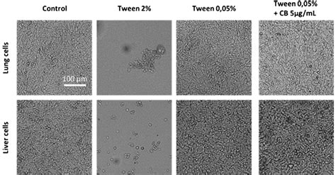 Effect Of Tween 80 In Culture Cells Representative Brightfield