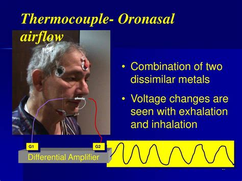 Obstructive Sleep Apnea Syndrome Management Approach Ppt Download