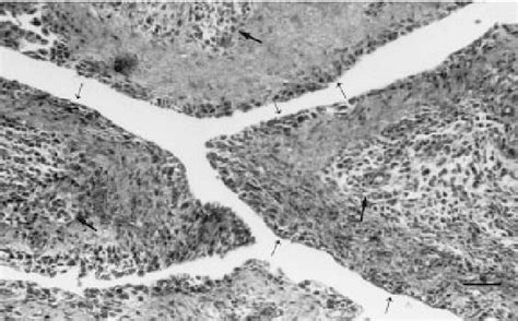 Ðdetection Of Bcl 2 Mrna Expression With An Antisense Oligonucleotide Download Scientific