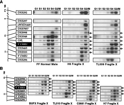 Figure 2 From A Variable Domain Of Delayed Replication In Fraxa Fragile