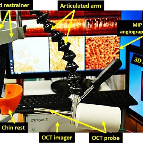 Optical Coherence Tomography Angiography Octa Acquisition System Download Scientific Diagram
