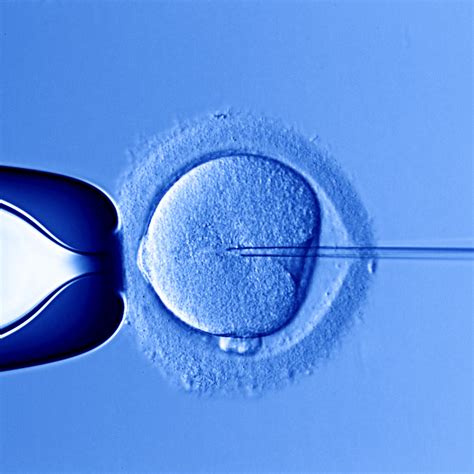 Assisted Hatching Tampa Bay Infertility Experts