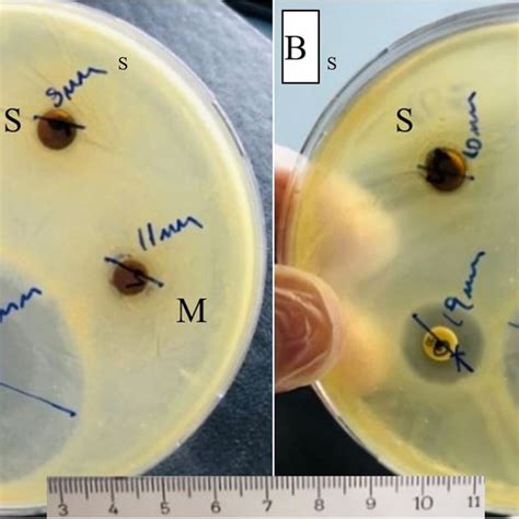 Antibiogram Test Results Of Antibiotics And Phytochemicals Used In The Download Scientific