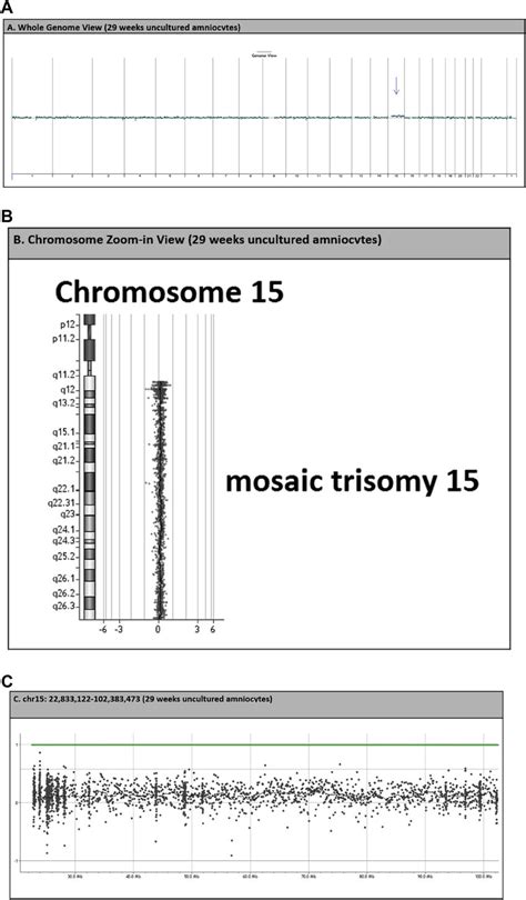A B And C Acgh Analysis On The Dna Extracted From Uncultured
