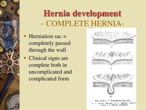 Ppt Hernia Of The Antero Lateral Abdominal Wall Powerpoint