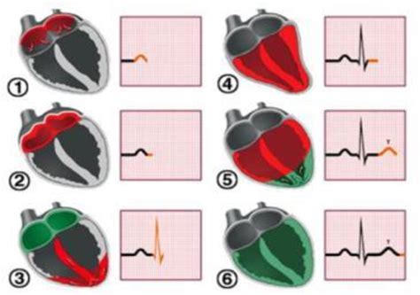 Figure 1 From Design And Fabrication Of Cost Effective Heart Rate Pulse Monitoring Sensor System