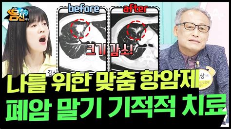 나는몸신이다 폐암 말기 진단 받고 절망하기엔 이르다💥 놀라운 효과 보여주는 3세대 표적 항암제🌈 폐암 항암 나는 몸신이다 435 회 Youtube