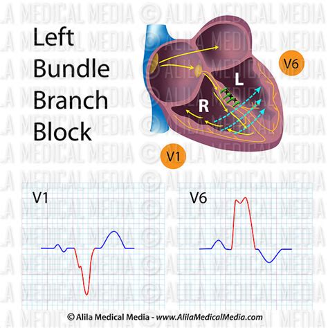 Alila Medical Media Heart And Circulatory System Images
