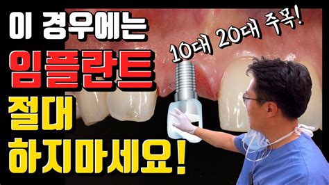이 경우에는 임플란트 절대 하지 마세요 10대 20대 주목 임플란트 대체 치료 공개 Youtube