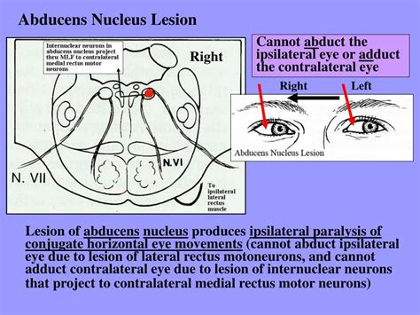 Ppt Oculomotor System Importance Of Eye Movements In Cns Assessment