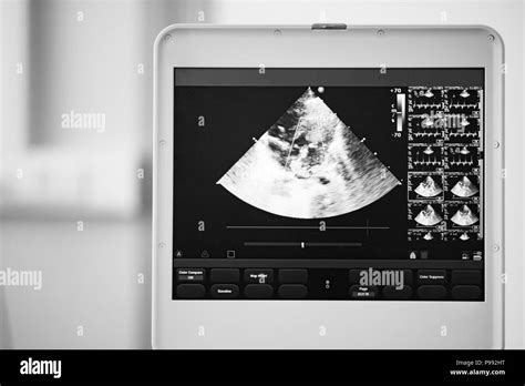 Echocardiogram Procedure Hi Res Stock Photography And Images Alamy