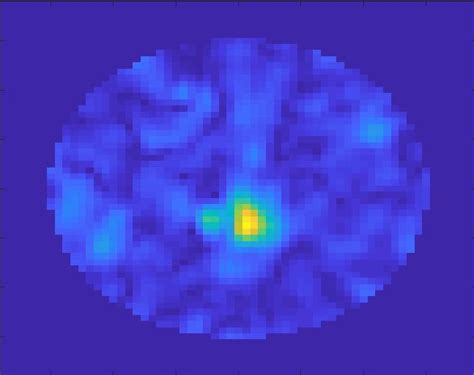 Tumor Object Detection Dataset V1 2022 09 26 228pm By Srm