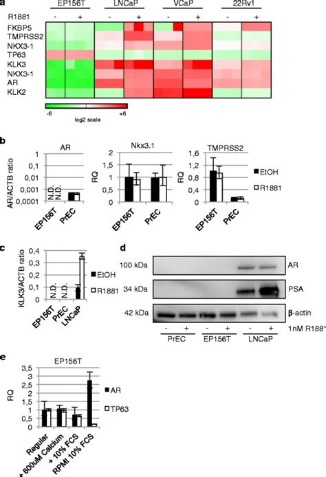 Expression Data Of Ep156t And Prec Cells A Agilent Microarray Gene Download Scientific Diagram