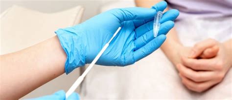 Feasibility And Compliance Of Hrhpv Self Sampling In Women With Hiv