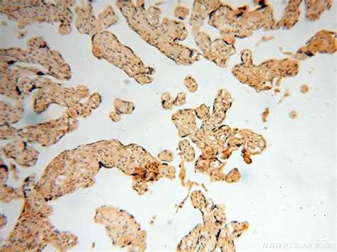 HLA Class I HLA B Fusion Protein Ag10782 Proteintech