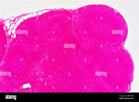 Lymph Node Or Lymph Gland With Capsule Lymphoid Nodule And Trabeculae