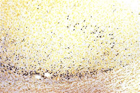 Neurodegeneration Detection With Fd Neurosilver™ Kit In The Brain Fd