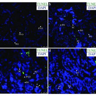 TUNEL Assay In The Gonads During Sex Reversal TUNEL Signals Were Download Scientific Diagram