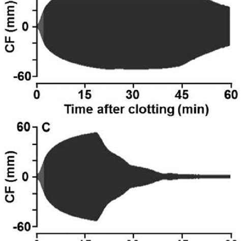Representative Rotational Thromboelastometry Tracings Recorded By Use Download Scientific
