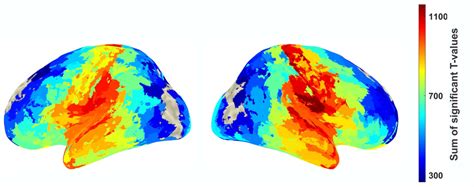 Speech Brain Coupling During Speaking Cortical Map Represents Groups