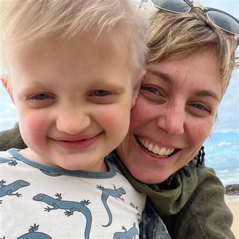 National Foundation For Ectodermal Dysplasias Nfed