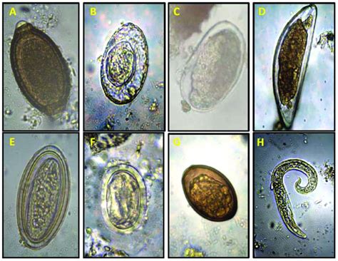 Helminth Eggs Recorded From Fecal Samples Of Rodents All Images Were