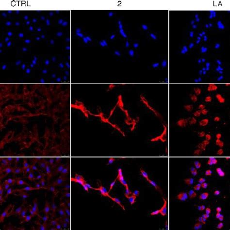 Human Topoisomerases I Relaxation Assays Supercoiled Dna Was Used As