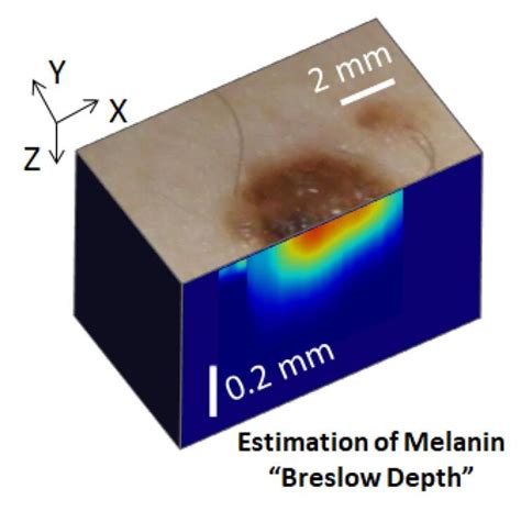 Depth Resolved Quantitative Imaging of Tissue Ultra Structure Linköping University
