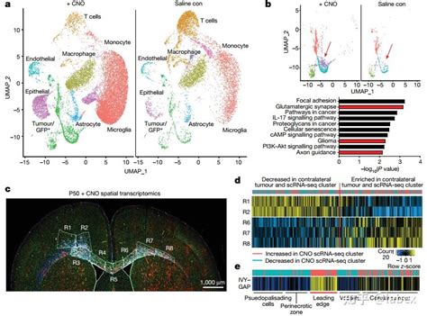 单细胞 空间转录组探秘：远端神经元竟能遥控脑胶质瘤进展！ 知乎