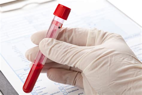 Std Blood Test Results Explained — Same Day Std Testing In Clia