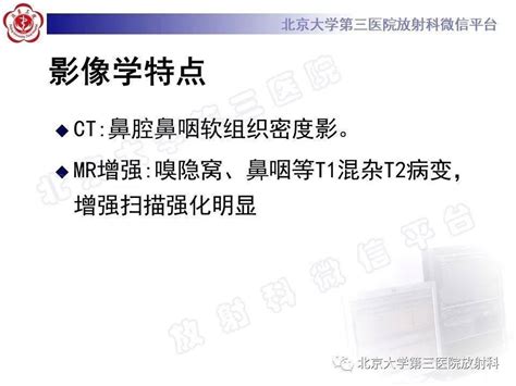 嗅神经母细胞瘤的影像表现解剖图全网系统