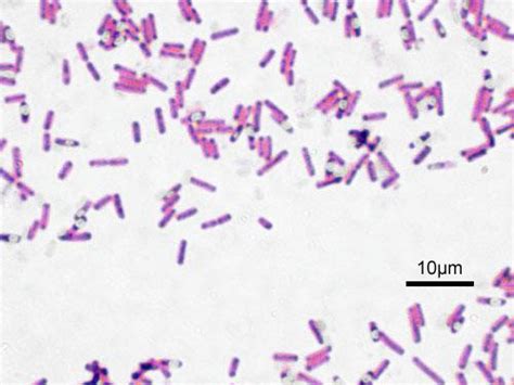 Gram Positive Bacilli Rods Microbiology Learning The Whyology Of