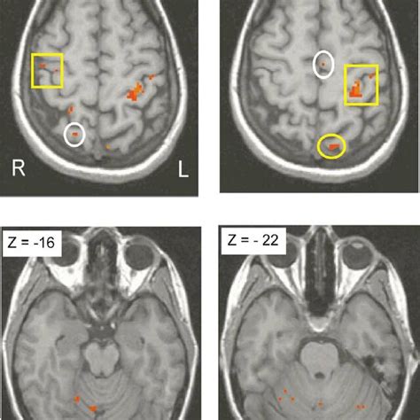 Comparison Of Bimanual Versus Right Handed Execution Of Finger