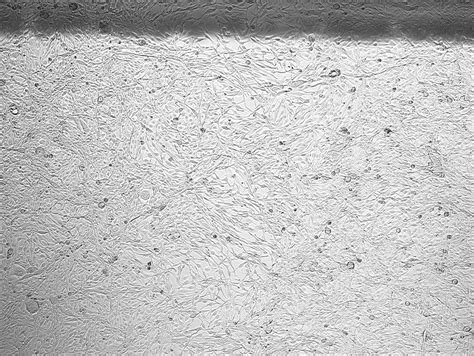 细胞划痕实验保姆级教程 知乎