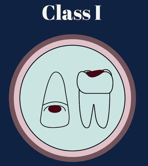 Tooth Numbering System Diagram Svg Png Jpeg Ai Pdf Dental Dentistry Jaw Dent Dentalbabe