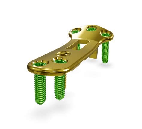 Костная пластина для остеотомии большеберцовая кость 26 04 50 00303 Astrolabe