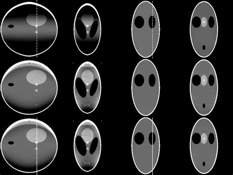 Two Dimensional Slices In 3 D Images Reconstructed By Use Of The Fdk