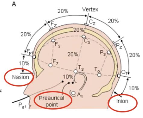 Week 9 Acquisition Parameters Flashcards Quizlet