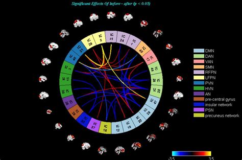 Tecas Group There Were Increased Dmn−dan And Dmn−rfpn Connectivity