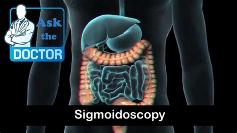 Sigmoidoscopy Youtube