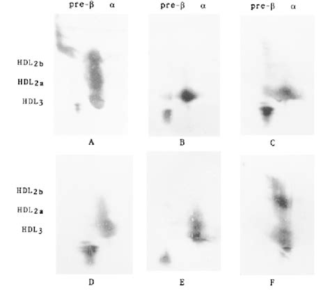 Distribution Of ApoA I In The HDL Determined By Twodimensional Gel Download Scientific Diagram